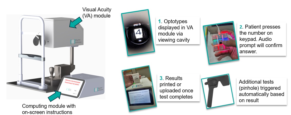 Automated Visual Acuity Test device (AVAT) - Digital Life Line
